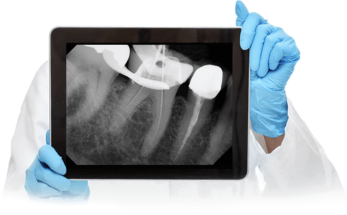 Technology – Precision Endodontics